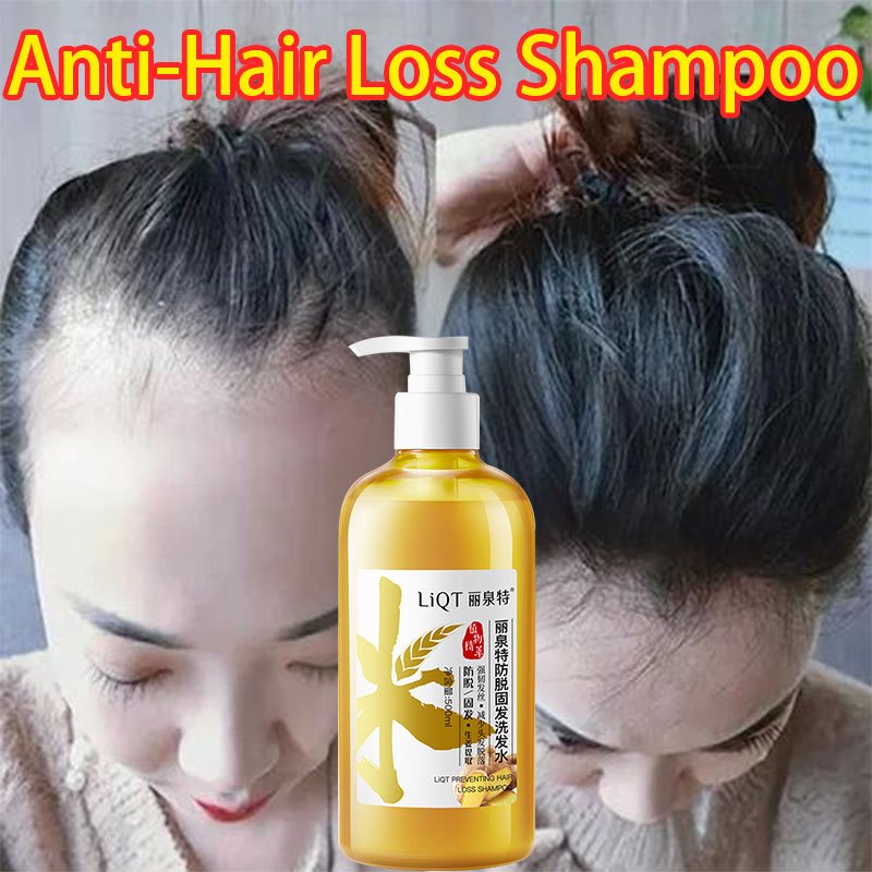anti hair loss shampoo Ginger shampoo 500ml Anti hair loss/Fast hair ...