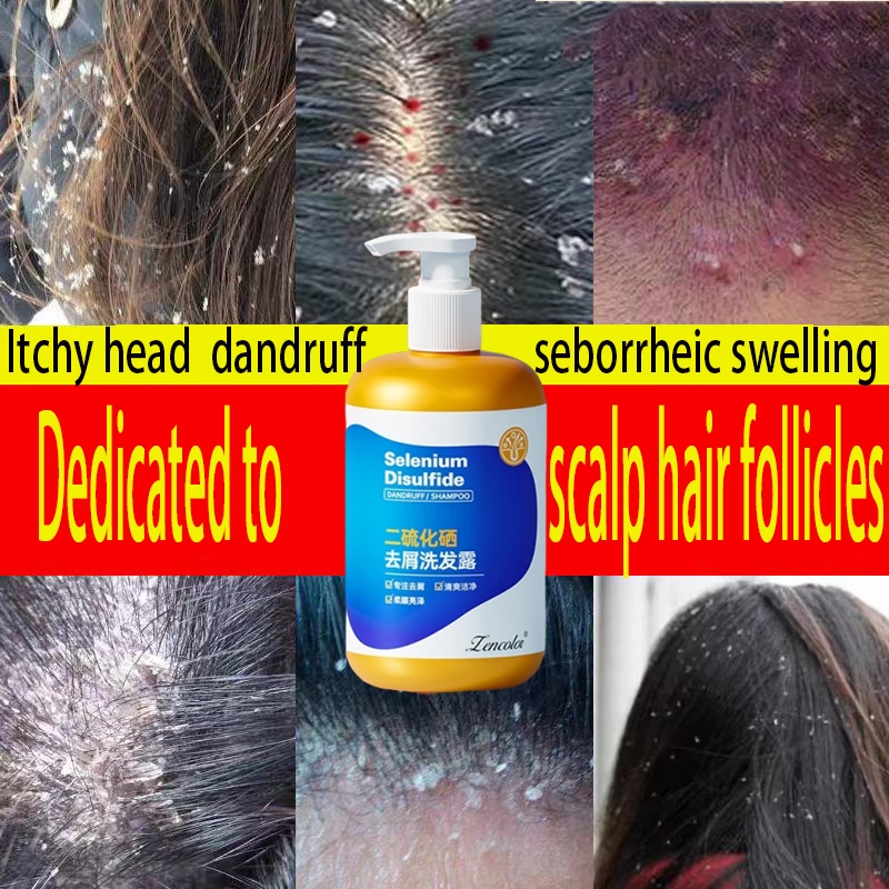 Dandruff shampoo genuine goods antiitching shampoo effectively remove ...