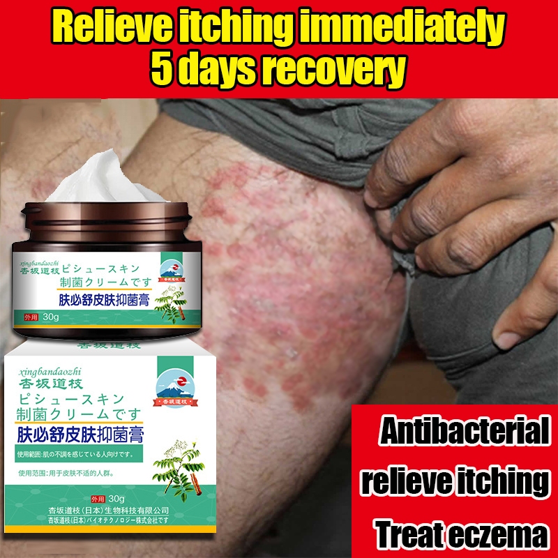 Private antifungal cream Anti-itch cream Eczema Cream treatment krim ...