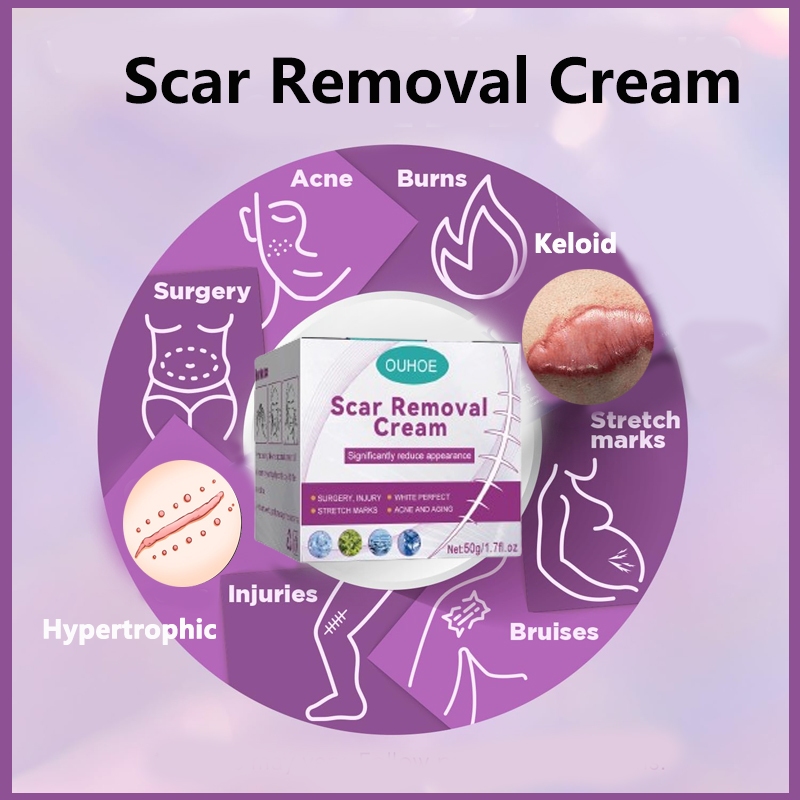 Parut Removal Cream Scar Remover Gel Keloid Hyperplasia Repair Scar ...