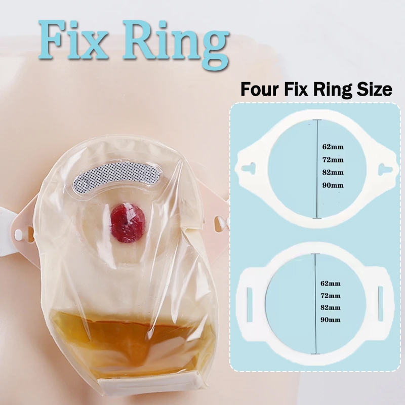 Fix Ring Ostomy Bag Reinforcer Adjustable Ostomy Bag Reinforcement ...