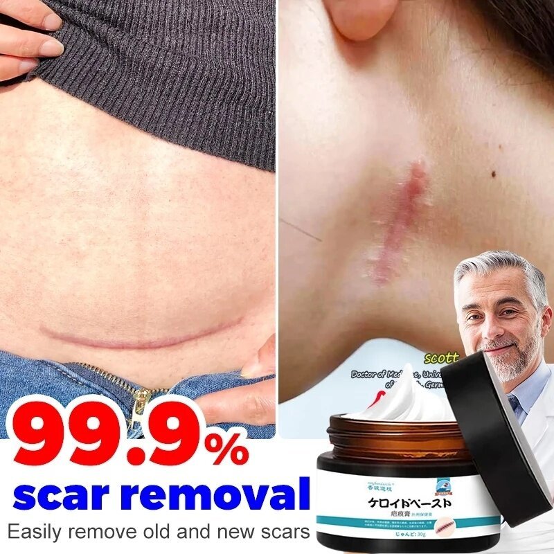 Japanese Scar Removal Cream Repair Old Scars Hot Scars Worm Bite Scars ...