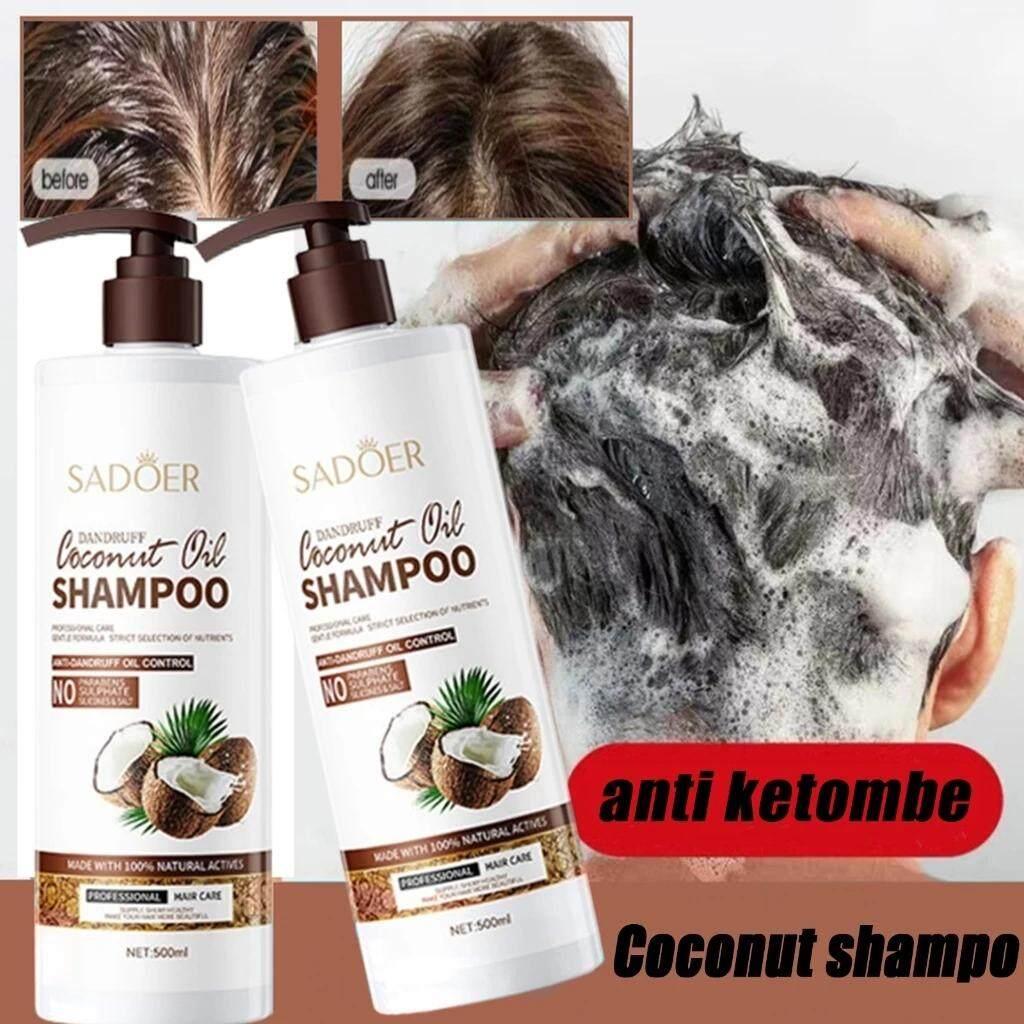 SADOER Dandruff Coconut Oil Shampoo Nourishing Smooth Fluffy Anti-Dandruff Oil Control Shampoo ...