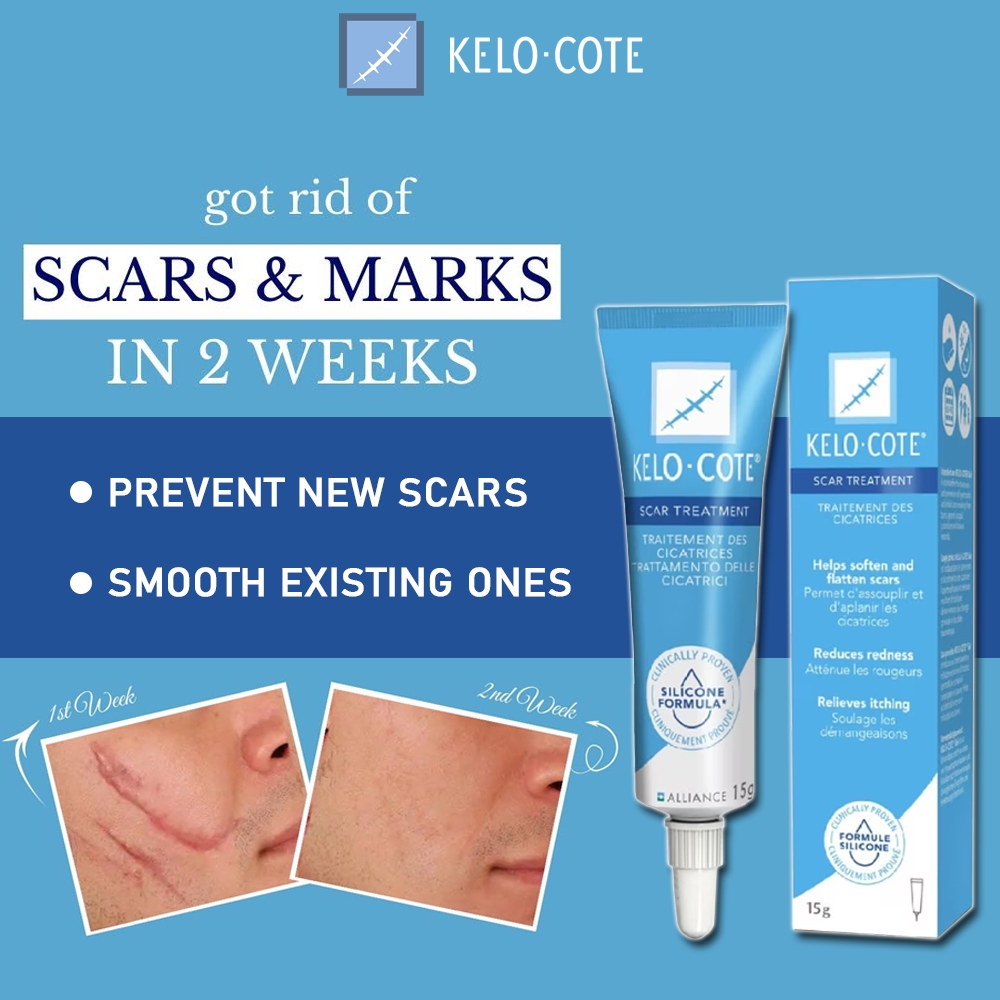 KELO-COTE Silicone Scar Gel 15g for Scar Treatment Keloid Hypertrophic ...