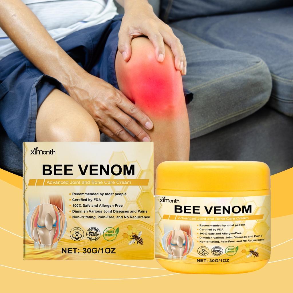 Joint Treatment Cream Joint Inflammation Relieving Knee Analgesic Edema ...