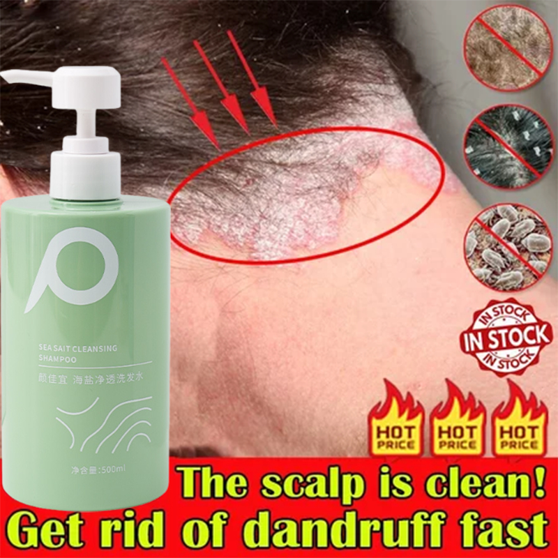 shampoo psoriasis anti dandruff shampoo syampoo kelemumur shampoo kutu ...