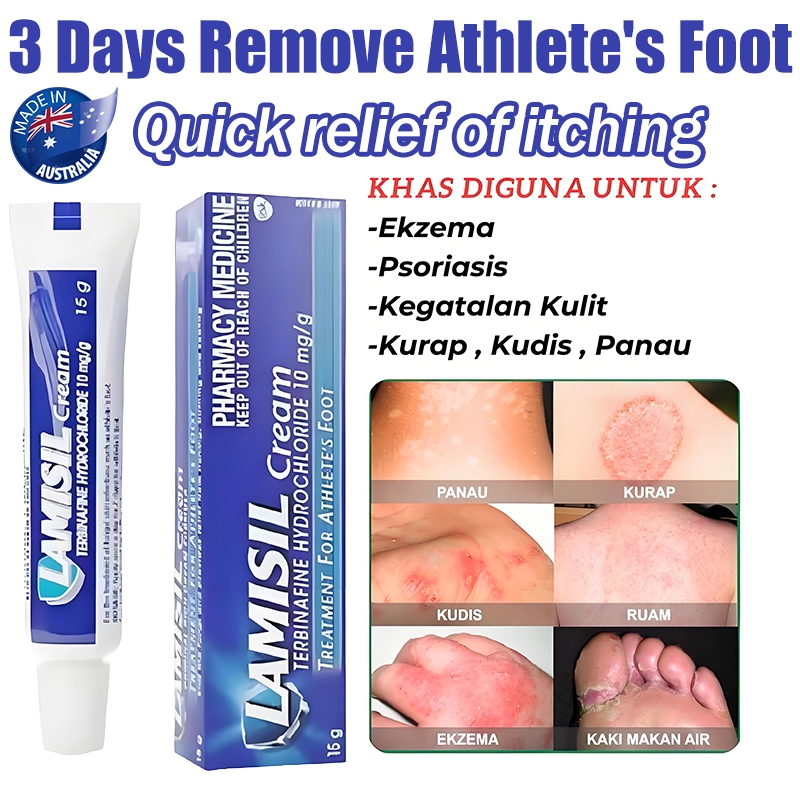 【Quick relief of itching】Ubat kulat air kaki 3 Days Remove Athlete's ...