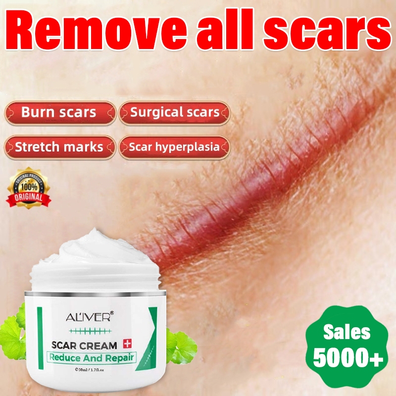 【Fast Delivery】aliver Scar Removal Cream Scar Removal Cream Fade Scars ...