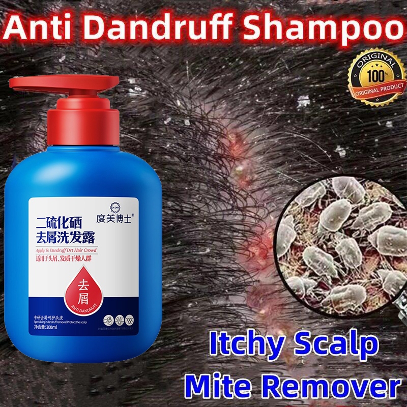 300ml selenium disulfide dandruff shampoo deeply cleanses hair ...