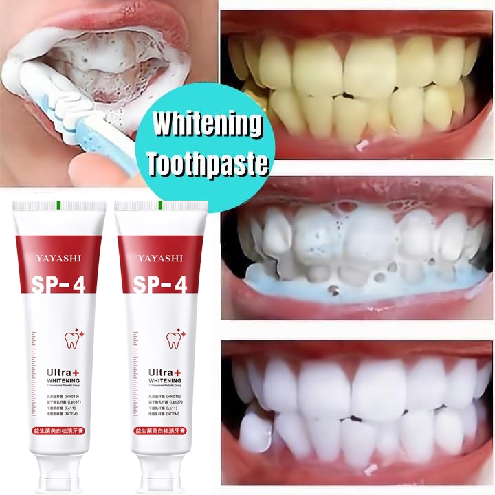 Probiotic Whitening Toothpaste Yellow Teeth Remover 120g Rapid ...