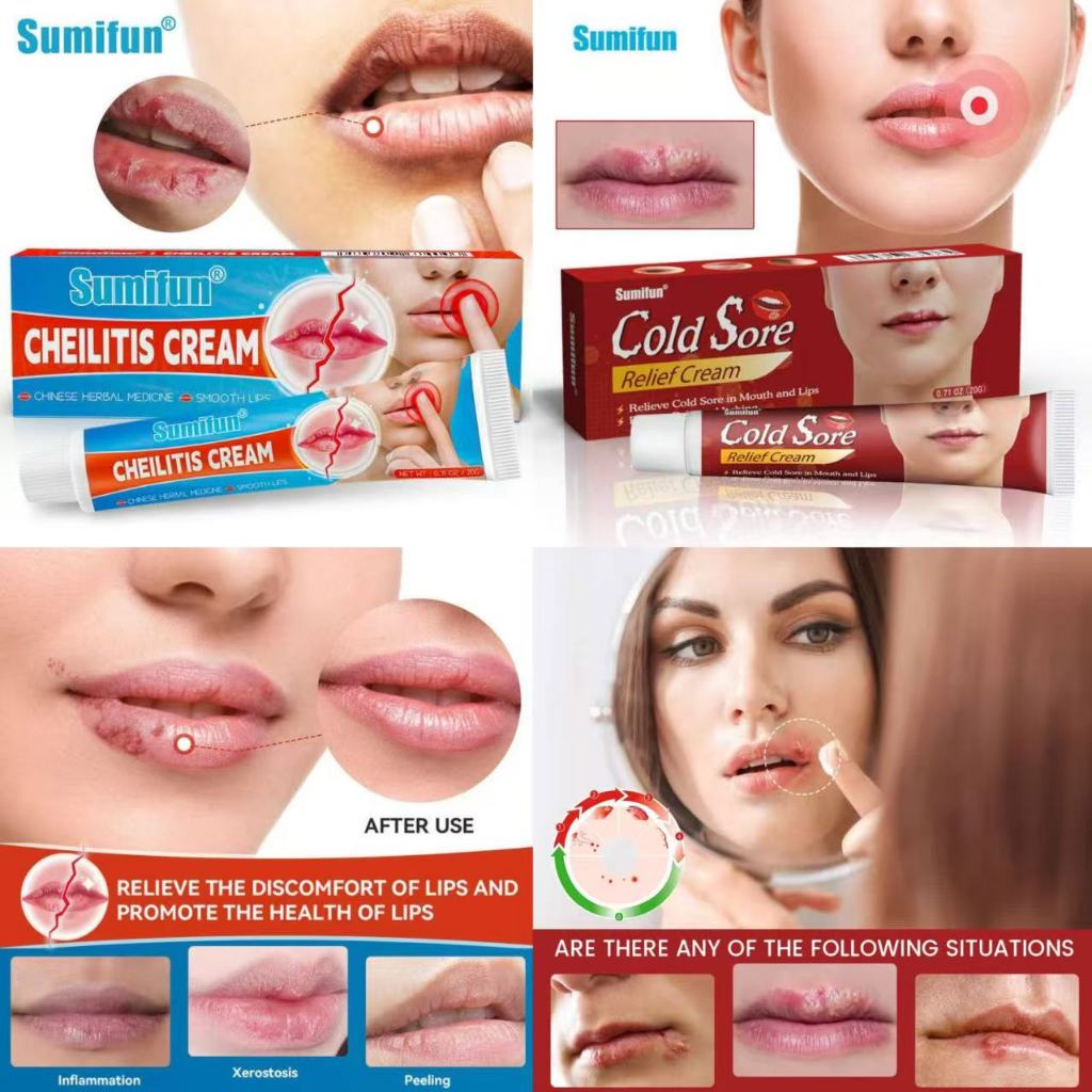 20g Cheilitis Balm Lip Care Skin External Cream Refreshing Hydrating ...