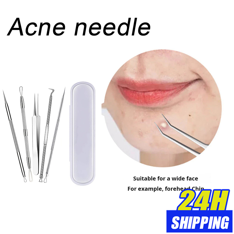Stainless Steel Cell Clip Acne Clip Blackhead Needle Acne Needle Acne ...