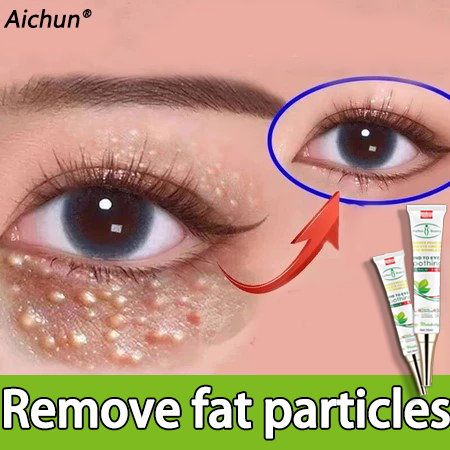 🌟Genuine🌟Fatty Bump Removal Eye Cream | Reduces Milia, Smoothens Skin ...