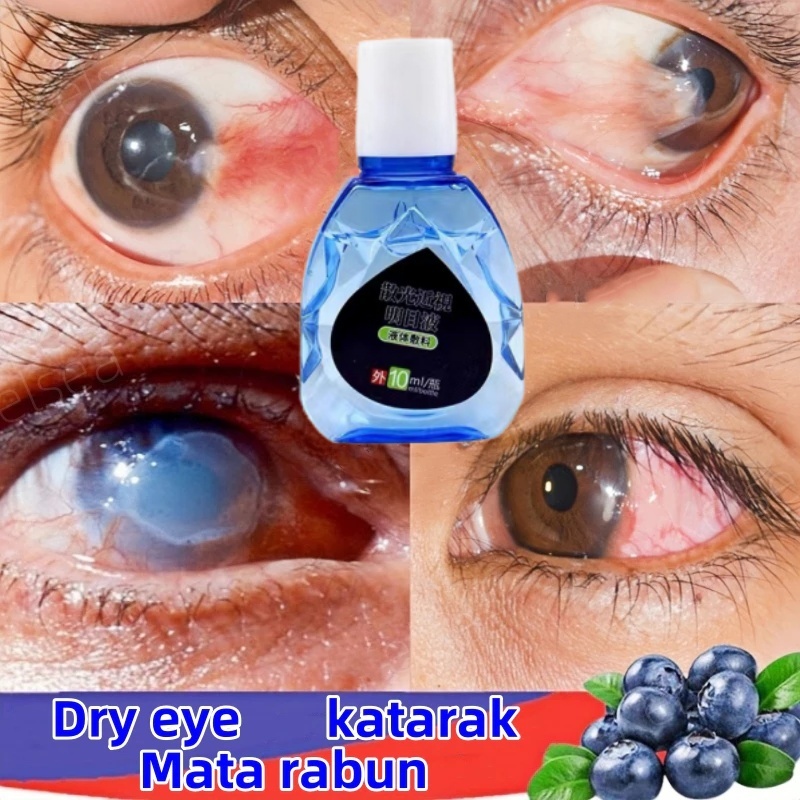 eye drop for cataract ubat mata ubat titis mata jepun merah ubat selaput mata obat katarak ...