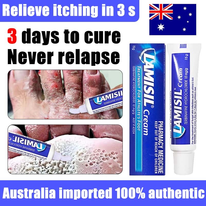 【Australian genuine】Ubat kulat kaki ubat kaaki Kaki mengelupas Kulat ...