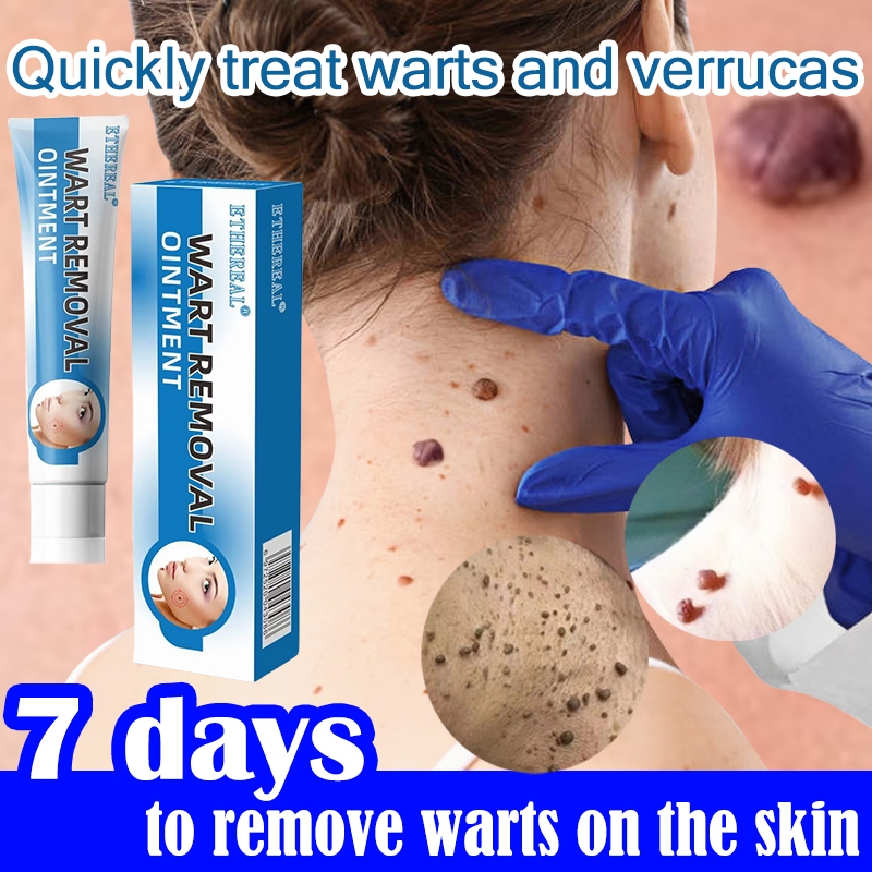 7days to remove warts on the skin Wart Removal Warts Remover remove ...