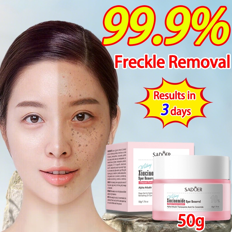 Whitening Freckle Cream 50g Remove Melasma Cream pigmentation cream ...