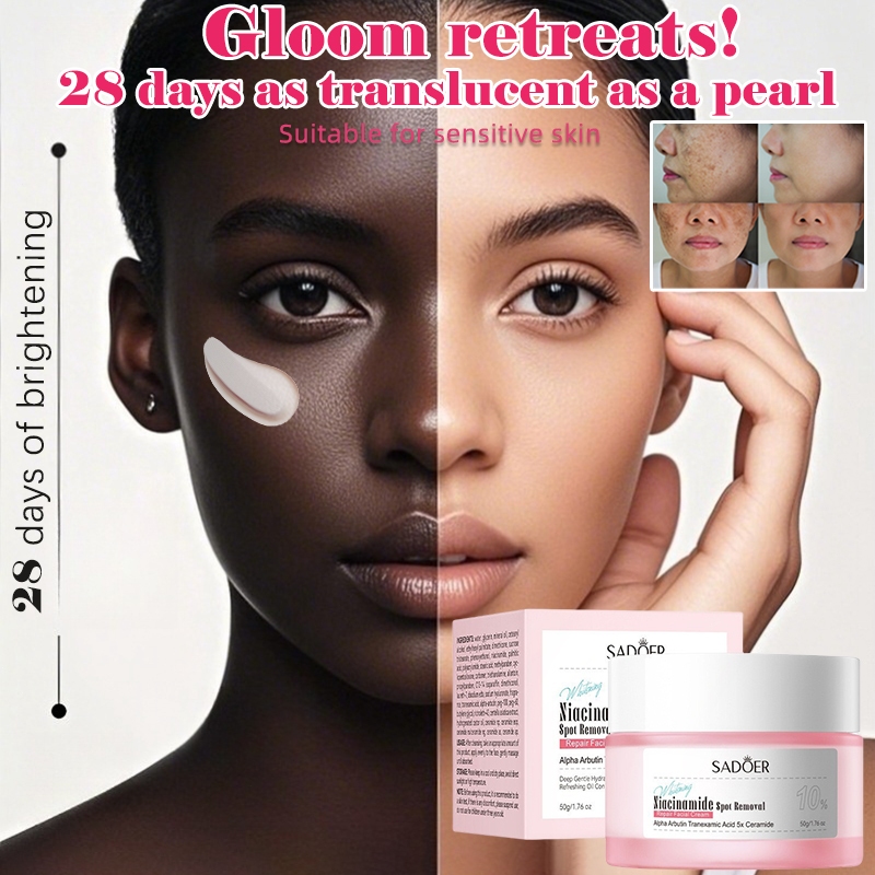 【Authentic products in stock】 Whitening Freckle Freckle Removing Dark ...