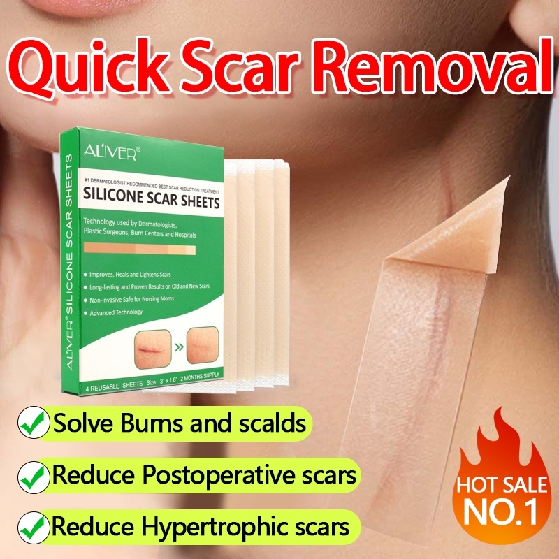 【Authentic】ALIVER 4Pcs/Box Scar Removal Patches | Medical Silicone Gel ...