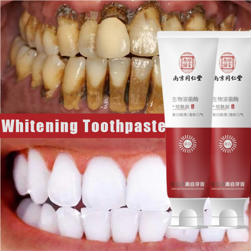 【24-hour shipping】 teeth whitening toothpaste Toothpaste whitening ...