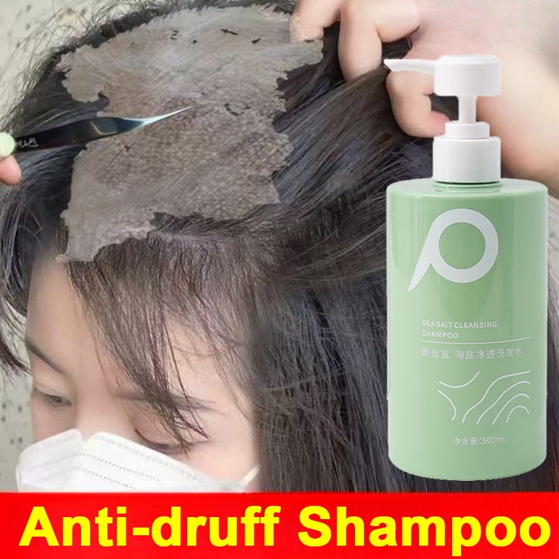 anti dandruff shampoo dandruff treatment oil control sea salt Shampoo ...