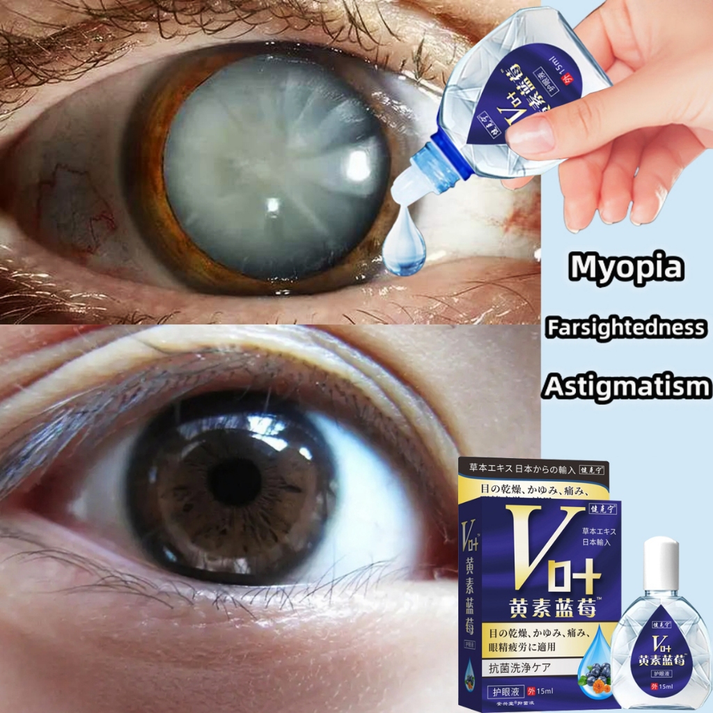 Cataract eye drops Cataract removal relieve eye fatigue eye drops for ...
