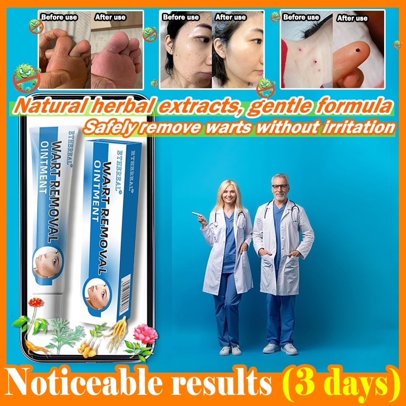 Warts Flat Eliminate Wart Pen Wart Liquid Hand Foot Warts Remove ...