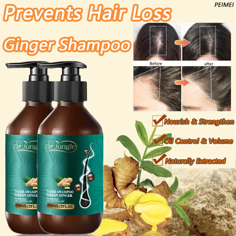 【Authentic】Anti-Hair Loss Shampoo 500ml – Powerful Ginger Formula, Strengthens Roots, Reduces ...