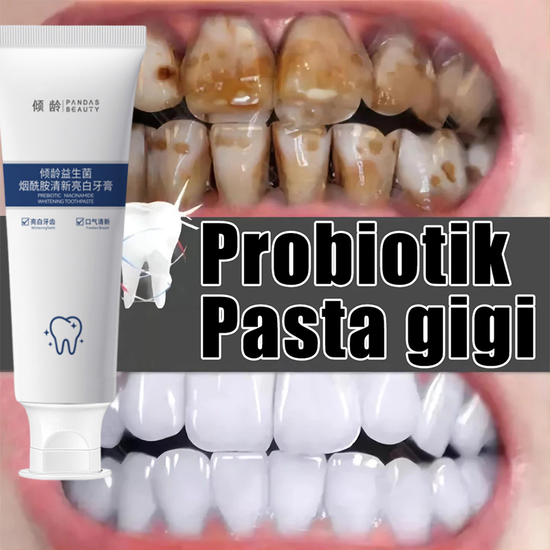 teeth whitening toothpaste Tartar removal Fresh breath Whitening and ...