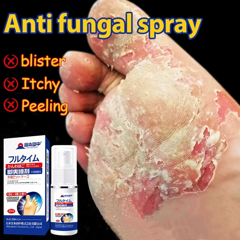 japan foot spray deodorant footlogix anti fungal spray 30ml Itchy foot ...