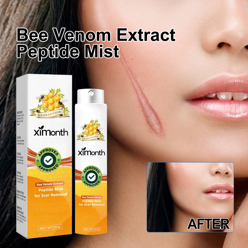 Scar Remove Medical Grade Scar Spray, Acne Scar Treatment, Scar Removal ...