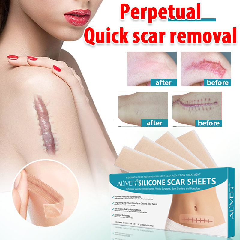 aliver scar removal patch scar removal patch scar lightening scar 4 pieces of double cesarean ...