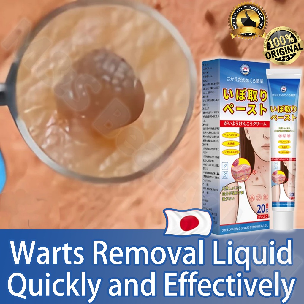 【100% original】wart removal cream 20g Flat warts, filiform warts ...