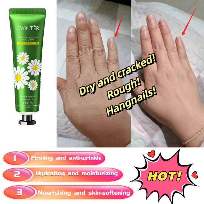 Hand Cream for Dry Hands,Hand Wrinkle-Free Moisturizer for Dry Skin ...
