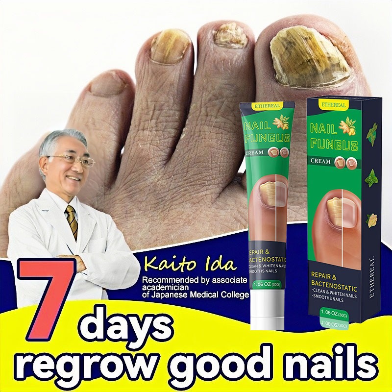 7days regrow good nails Nail Repair Onychomycosis Paronychia Nail ...