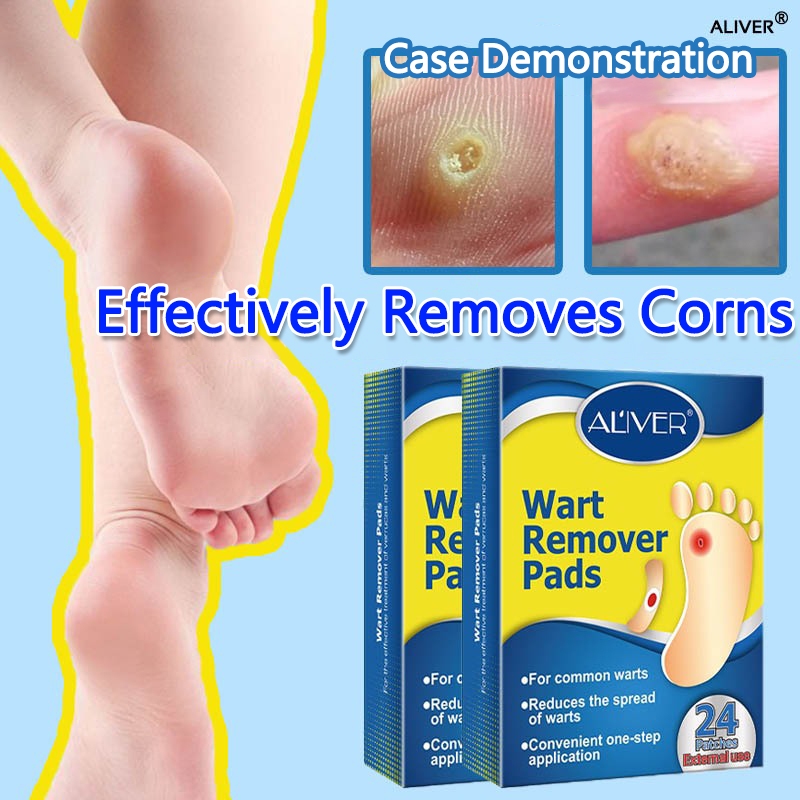 【Genuine】ALIVER Special patches for corns, hand and foot care, gentle ...