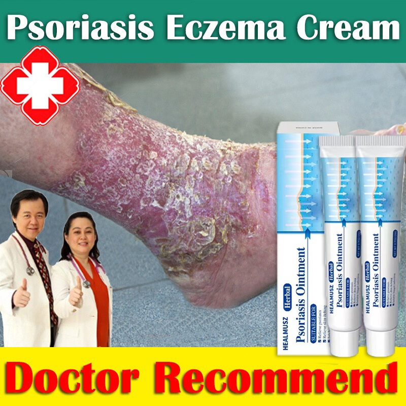 Eczema Cream Psoriasis Ointment Original Ubat Gatal Kulit Anti Fungal ...