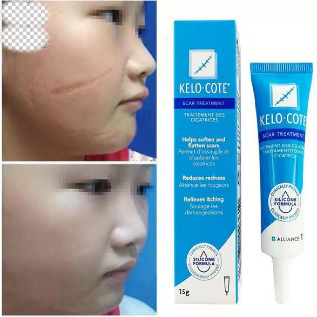 Kelo-Authentic Scar Repair Gel 15g Removal Scar Acne Cream Treatment ...
