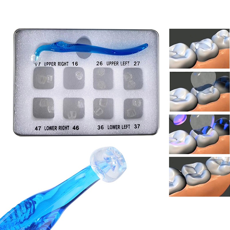 Dental Mould Veneer Kit Anterior Front Teeth Partner Kit Posterior ...