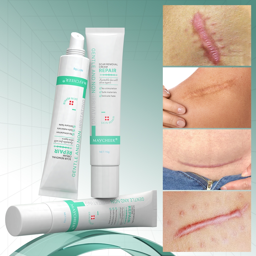 Effective Old Scar Remover for Legs Peklat Remover Acne Surgical ...