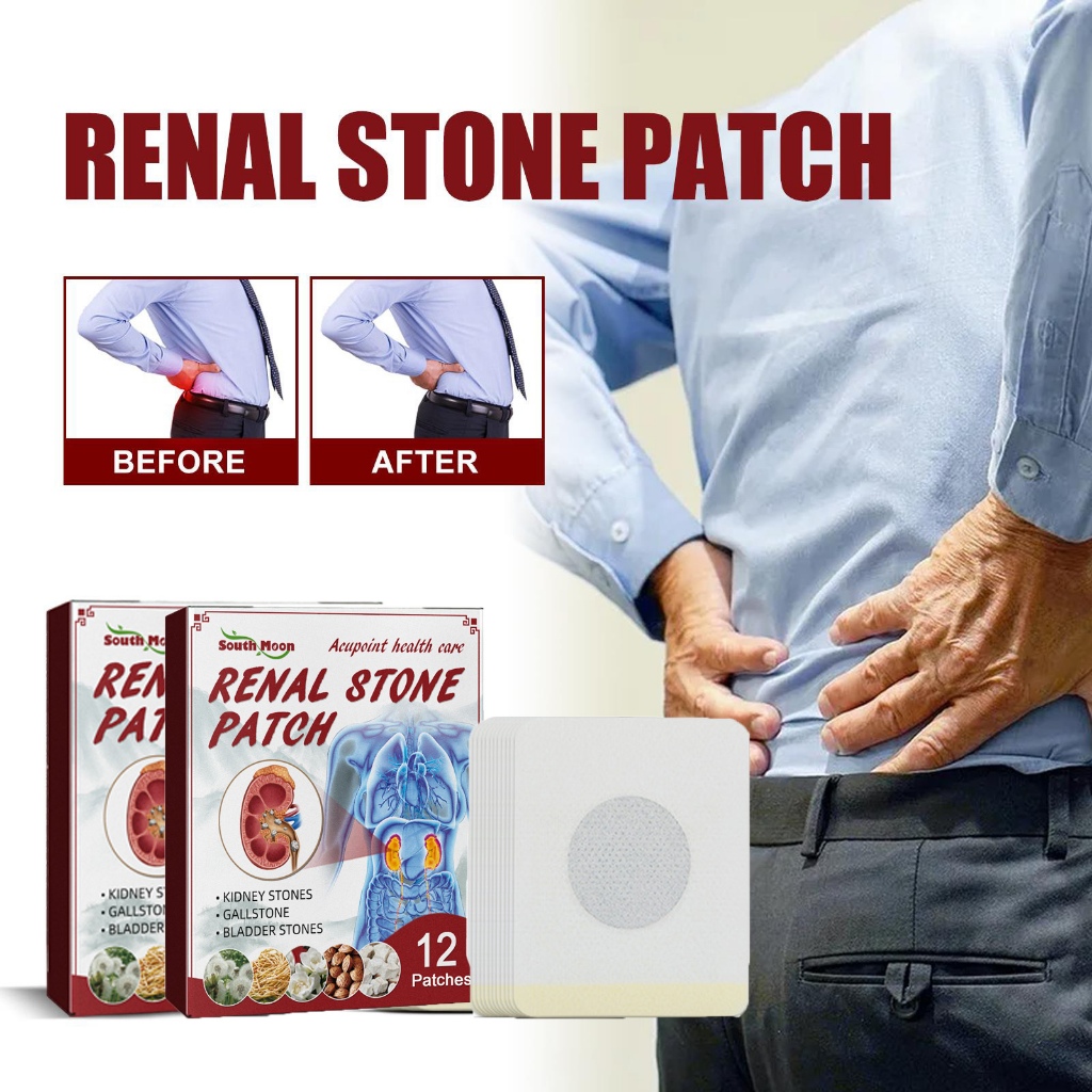 24Pcs/2box Renal Calculus Removal Plaster Treat Kidney Stones ...