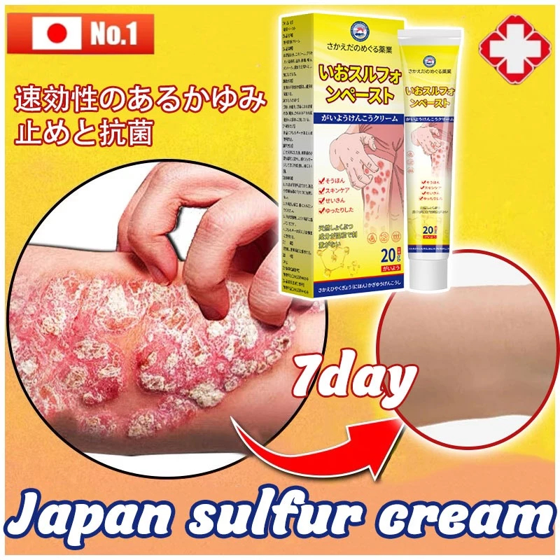 Japan Sulfur Eczema Antifungal Cream for Itchy Skin 20g Anti Itch Cream Treats Psoriasis Private ...