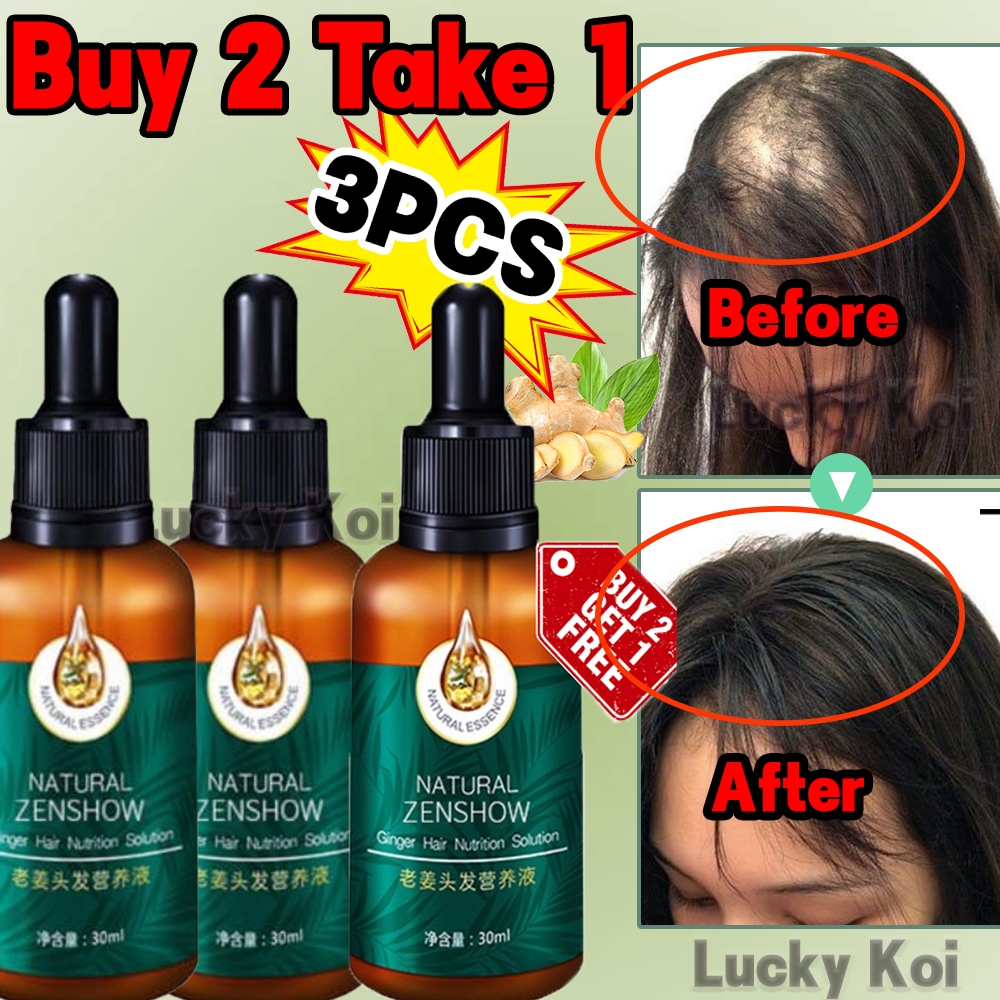 Ginger Hair Treatment 30ML Ginger Hair Growth Essential Oil Rapid Hair ...