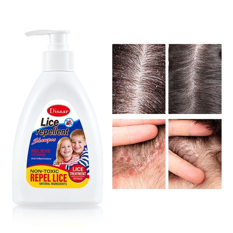 300ml Lice Repellent Shampoo 300ml Anti Dandruff Shampoo Anti Hair Loss ...