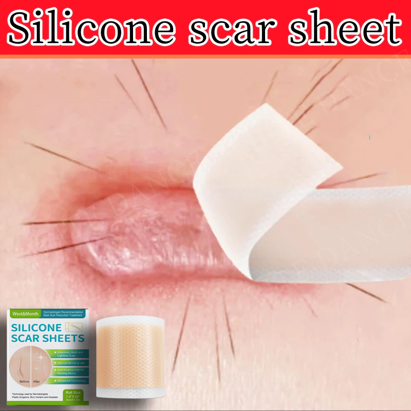 Silicone Scar Tape Scar Silicone Sheet Scar Patch Keloid Scar Remover ...