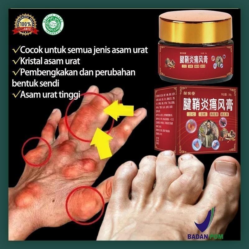 Bengor Chinese Herbal Medicine Gout Ointment Tenosynovitis Wrist Pain ...