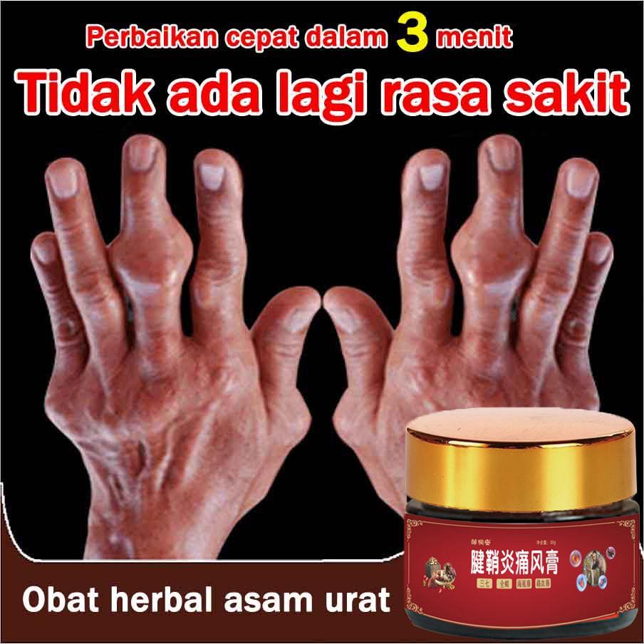 Gout ointment tendon sheath pain wind cream 30g anti-inflammatory ...