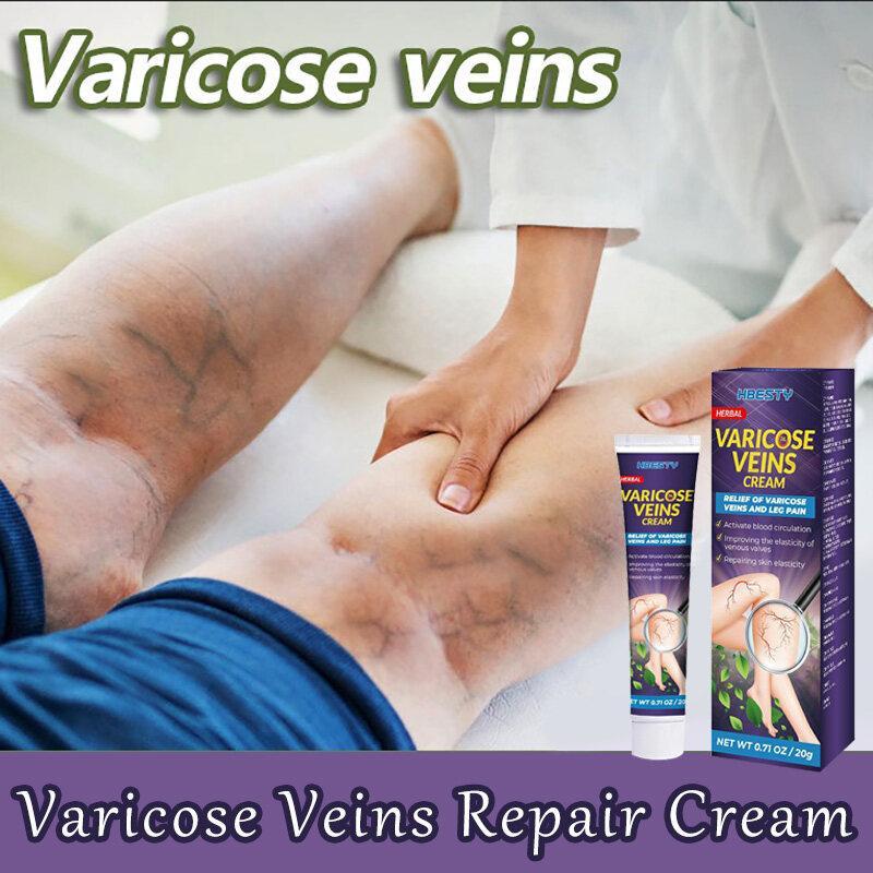 Venous ointment Varicose cream Venous cold compress gel relieves swelling of calf tendon ...