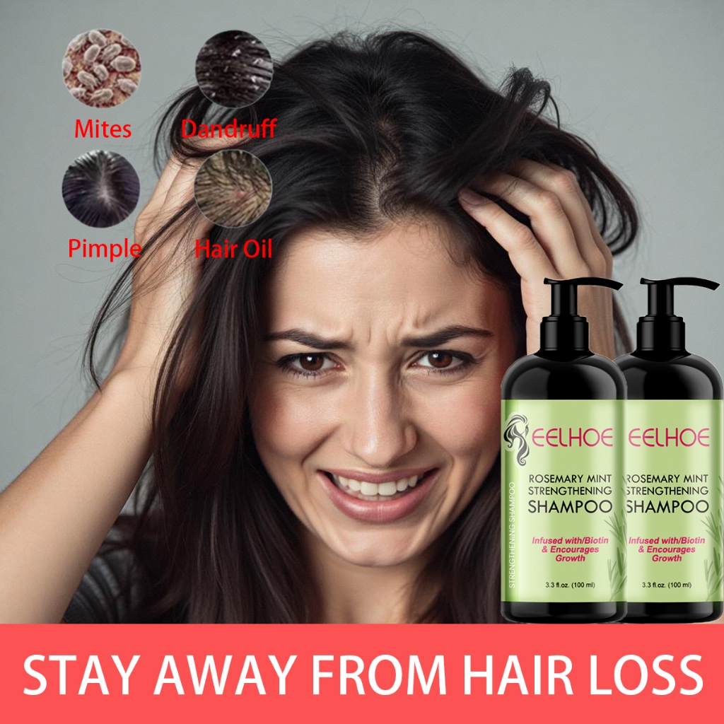 Scalp itching Shampoo, 100ml Scalp Care, Anti-Hair Loss Shampoo ...