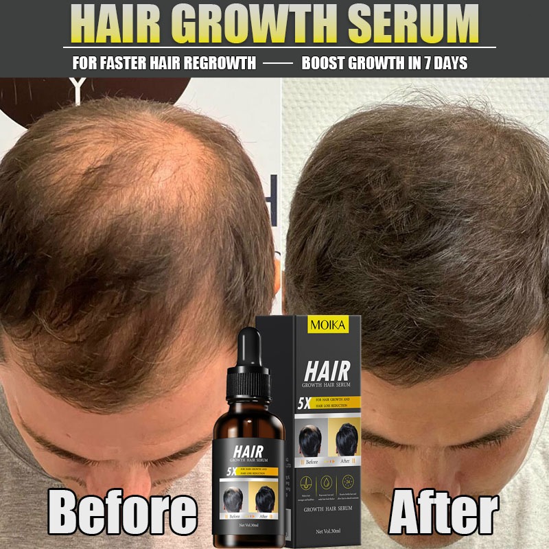 Hair Growth Serum hair tonic growth hair serum for hair growth 30ml ...